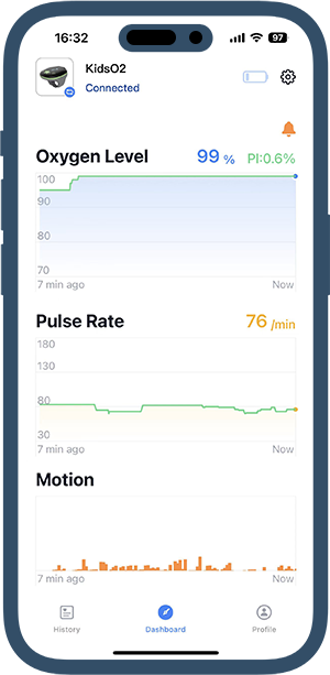Sleep Apnea Tracking Solution, Make Diagnose & Treat More Easily | Viatom