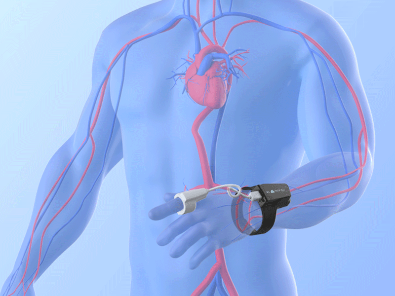 Wrist Oxygen Monitor for OSA - Checkme O2 Max | Viatom